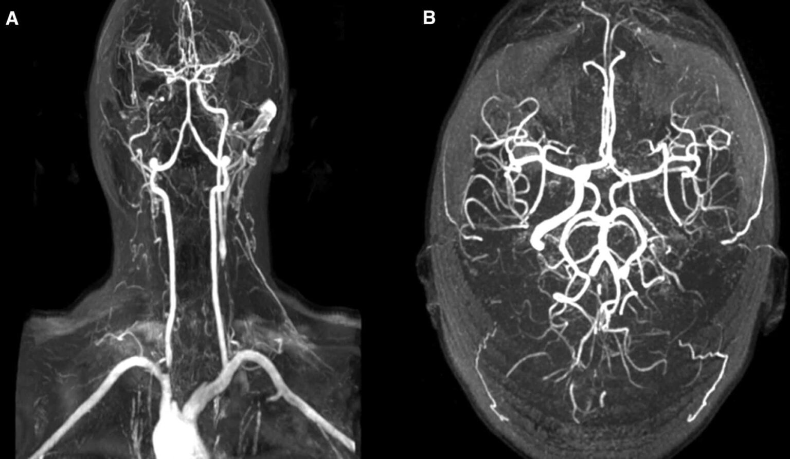 Ressonância magnética: o que é e como funciona